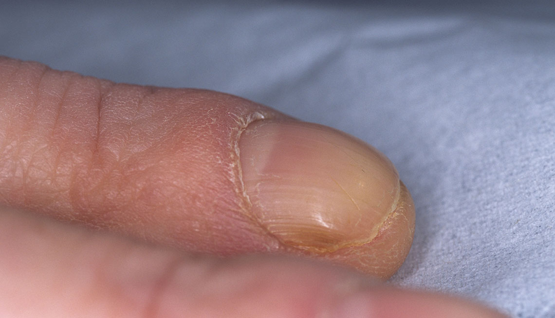Magnified Skin Under Fingernails
